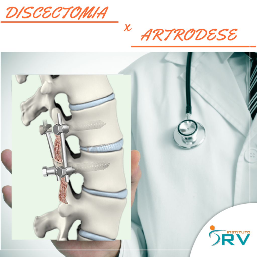 Discectomia para hernia de disco - Instituto RV